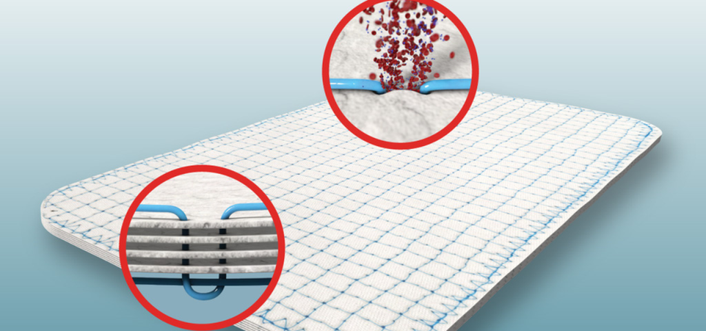 TELA Bio, Inc. - PRISM MarketView