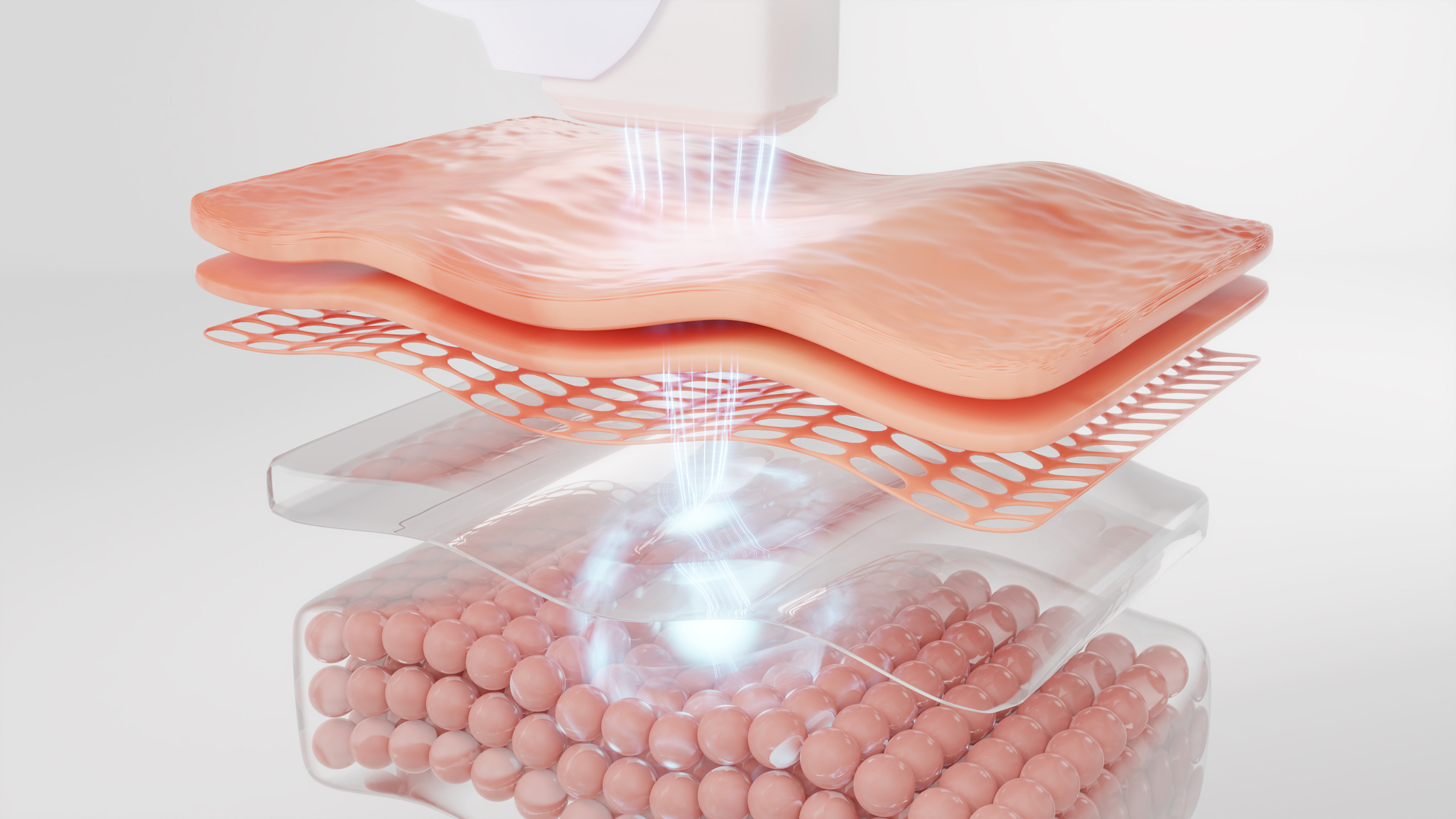 Sofwave Medical Secures FDA Clearance for Acne Scar Technology - PRISM ...