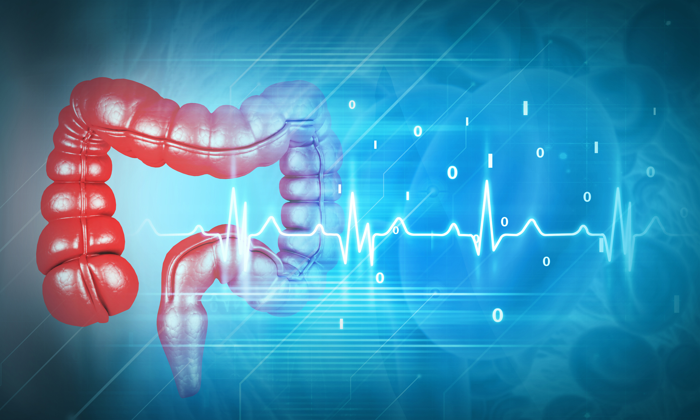 Intelligent Scopes Brings AI to Colon Cancer Detection - PRISM MarketView