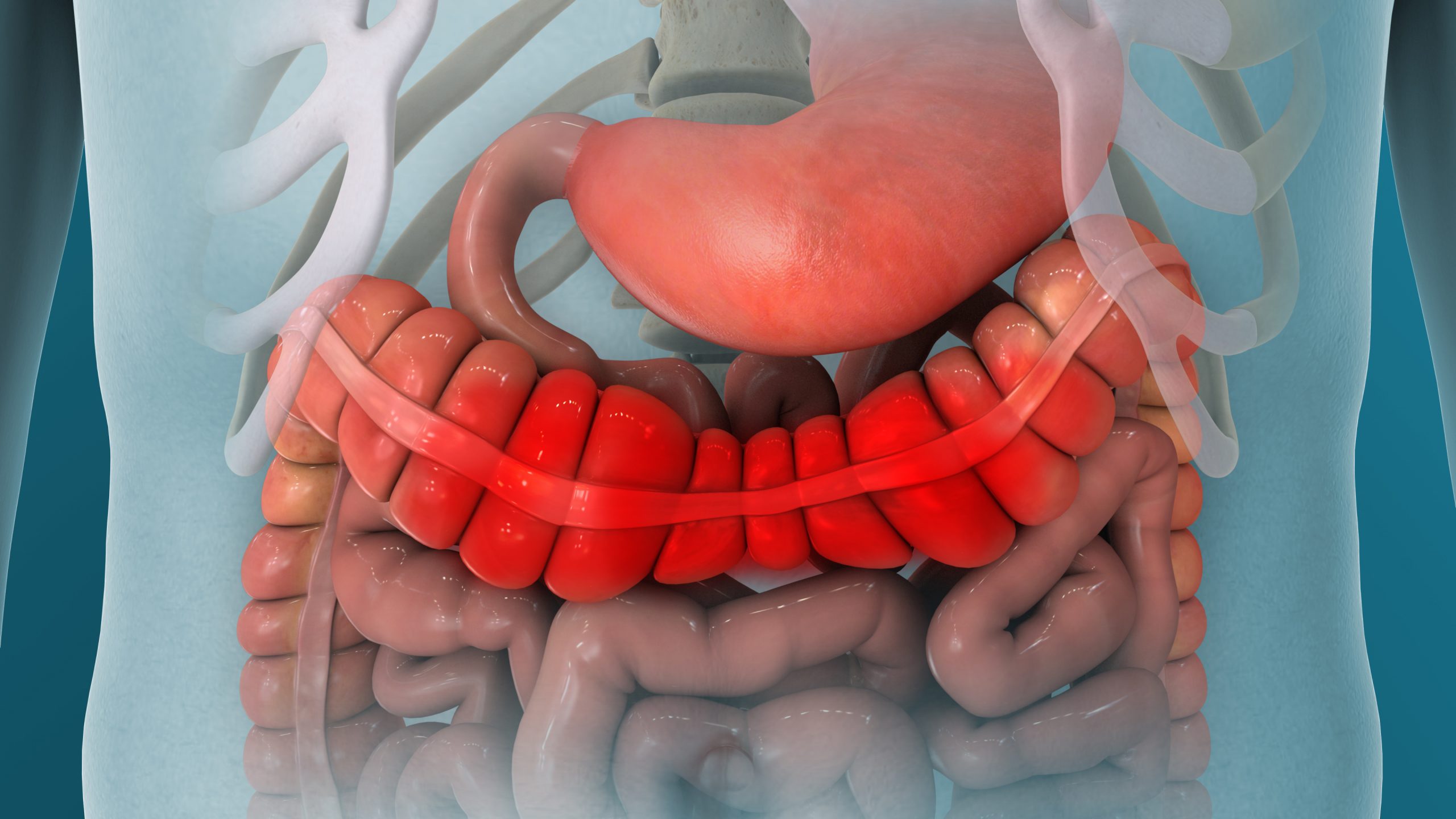 Palisade Bio Collaboration to Advance Precision Medicine for Ulcerative ...