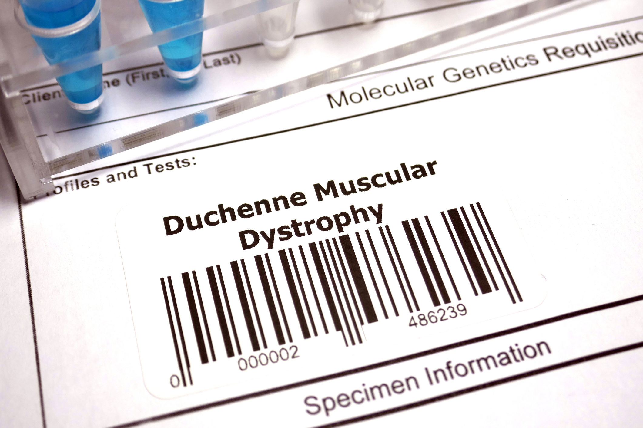 Capricor Therapeutics Advances Duchenne Muscular Dystrophy Candidate ...