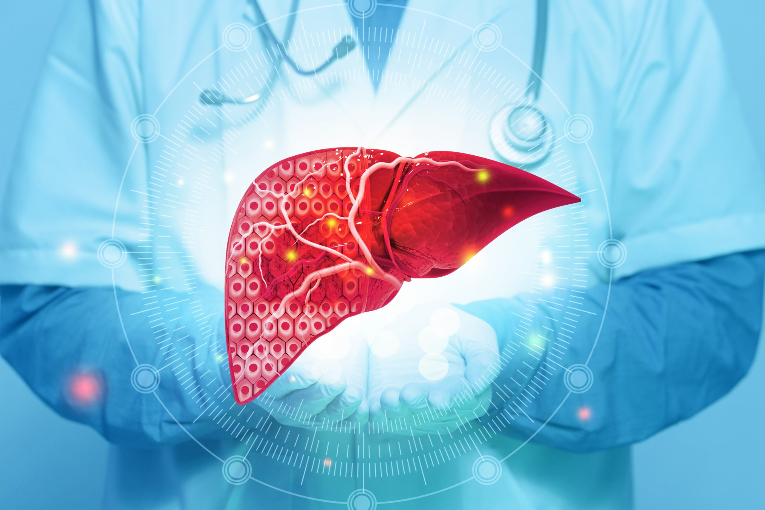 Surrozen Doses First Patient in Alcohol-Associated Hepatitis Study ...