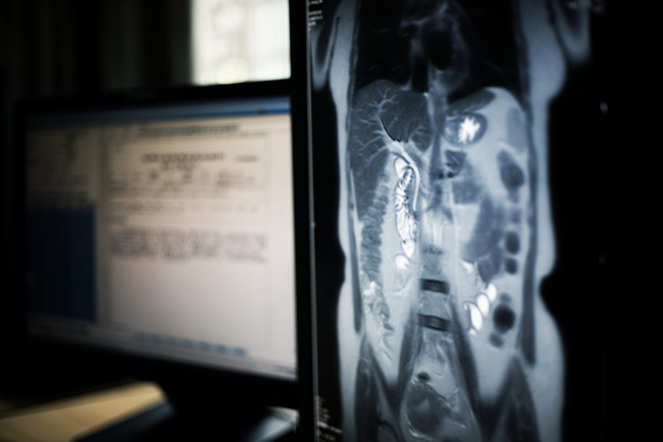 Lisata Therapeutics Secures FDA Orphan Drug Designation for Certepetide ...