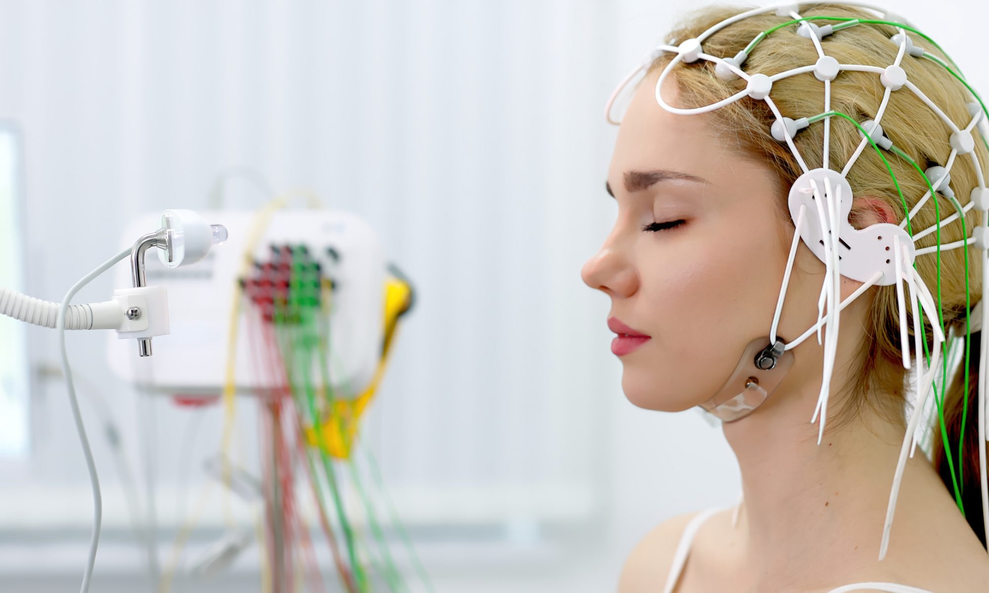 PRISM Healthcare Emerger Helius Medical Surpasses Stroke Trial Target ...