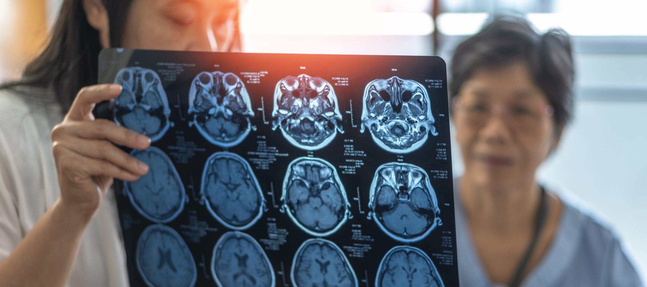 Alzamend Neuro Advances Alzheimer’s Drug Candidate into Phase II Trial ...