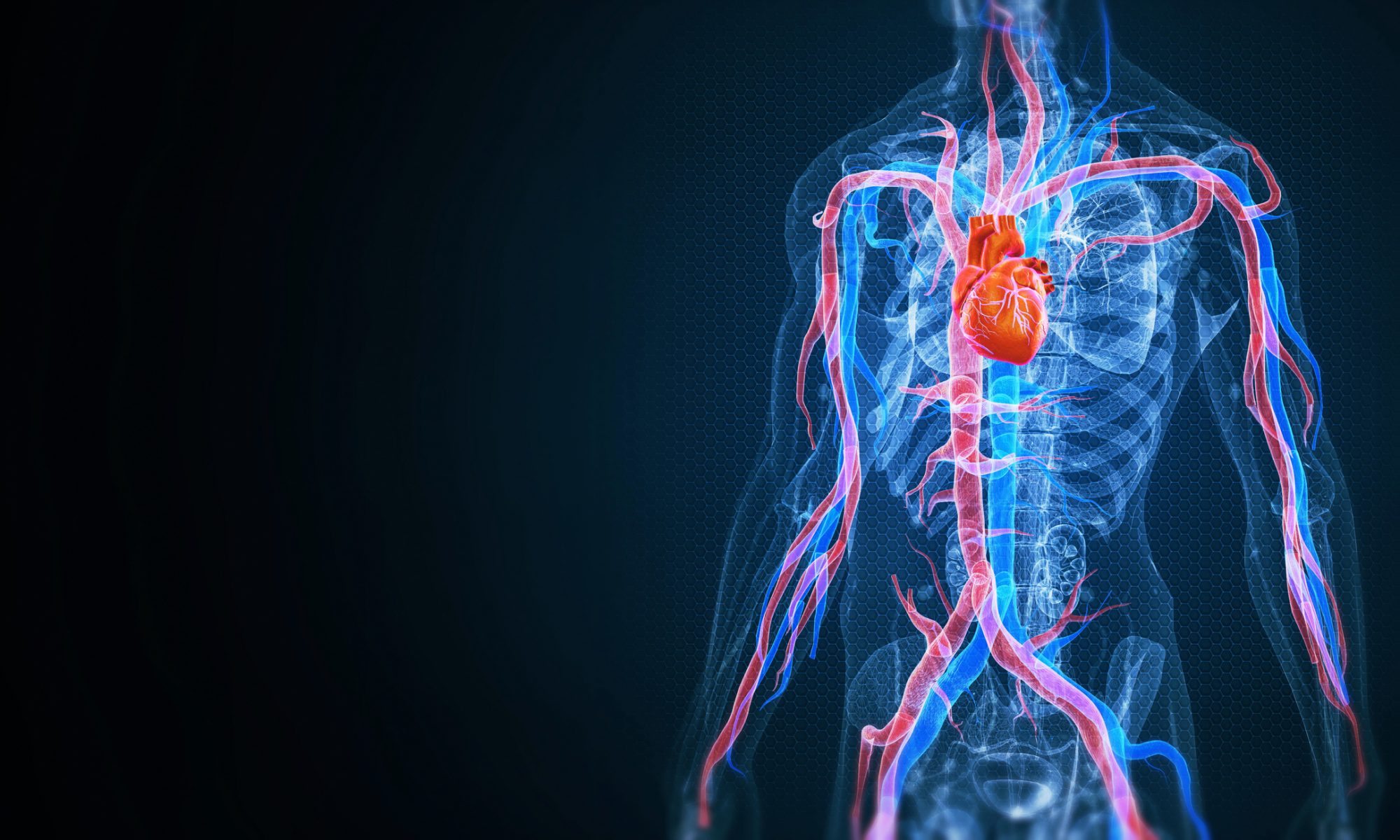 Catheter Precision Secures CE Mark for LockeT, Unlocking European ...