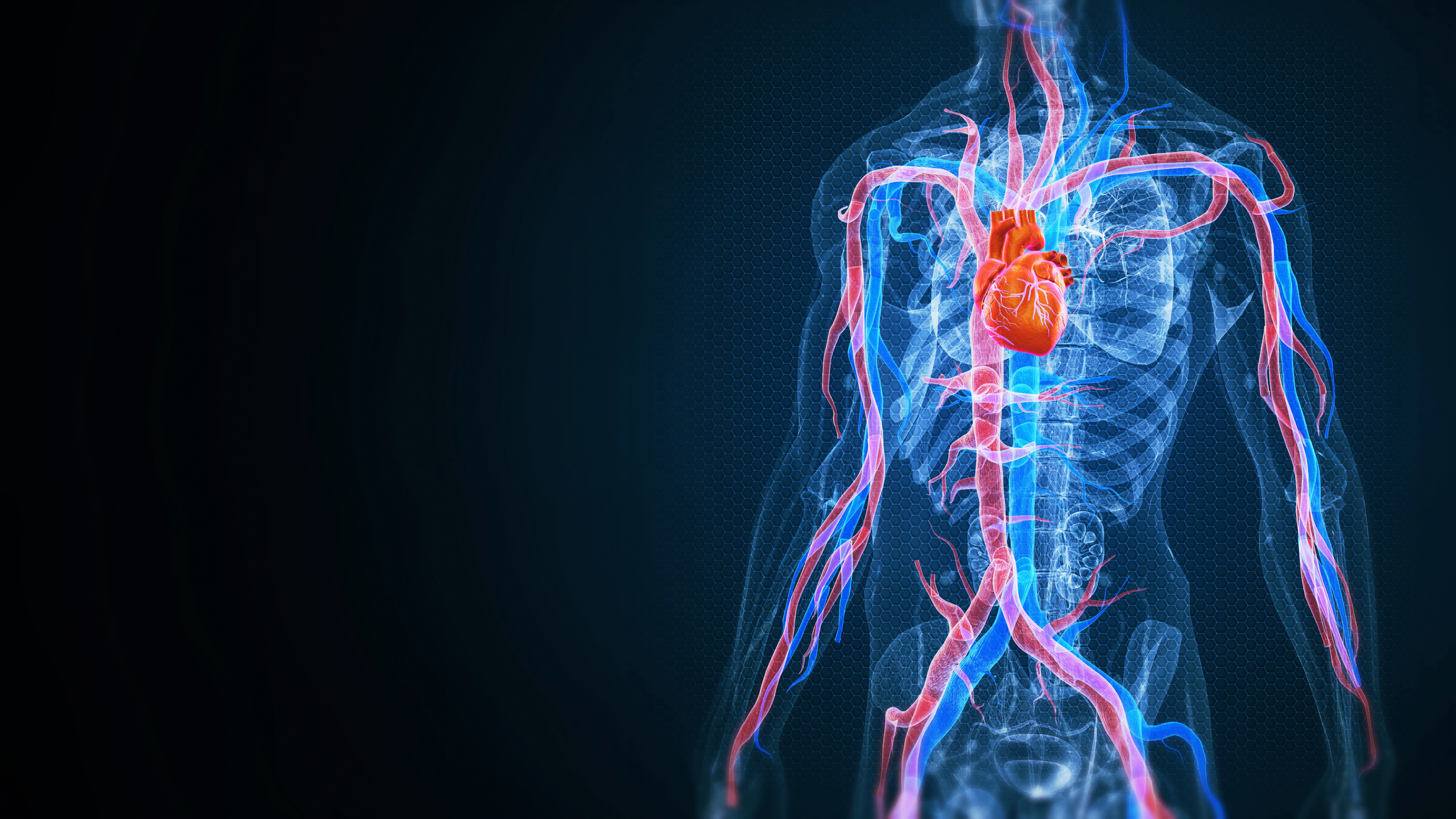 Catheter Precision Secures CE Mark for LockeT, Unlocking European ...