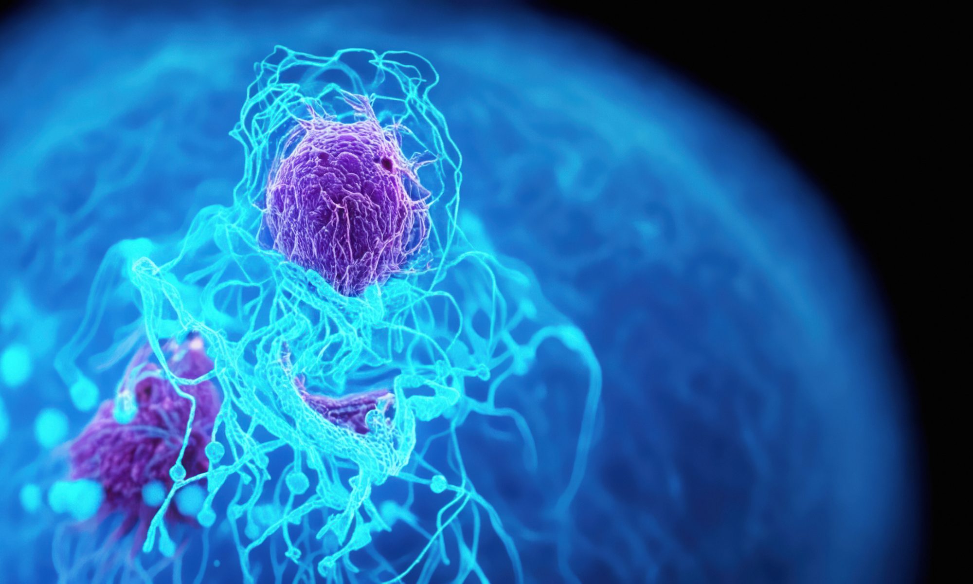 CERo Doses First Patient in CER-1236 Trial for AML, Advances ...