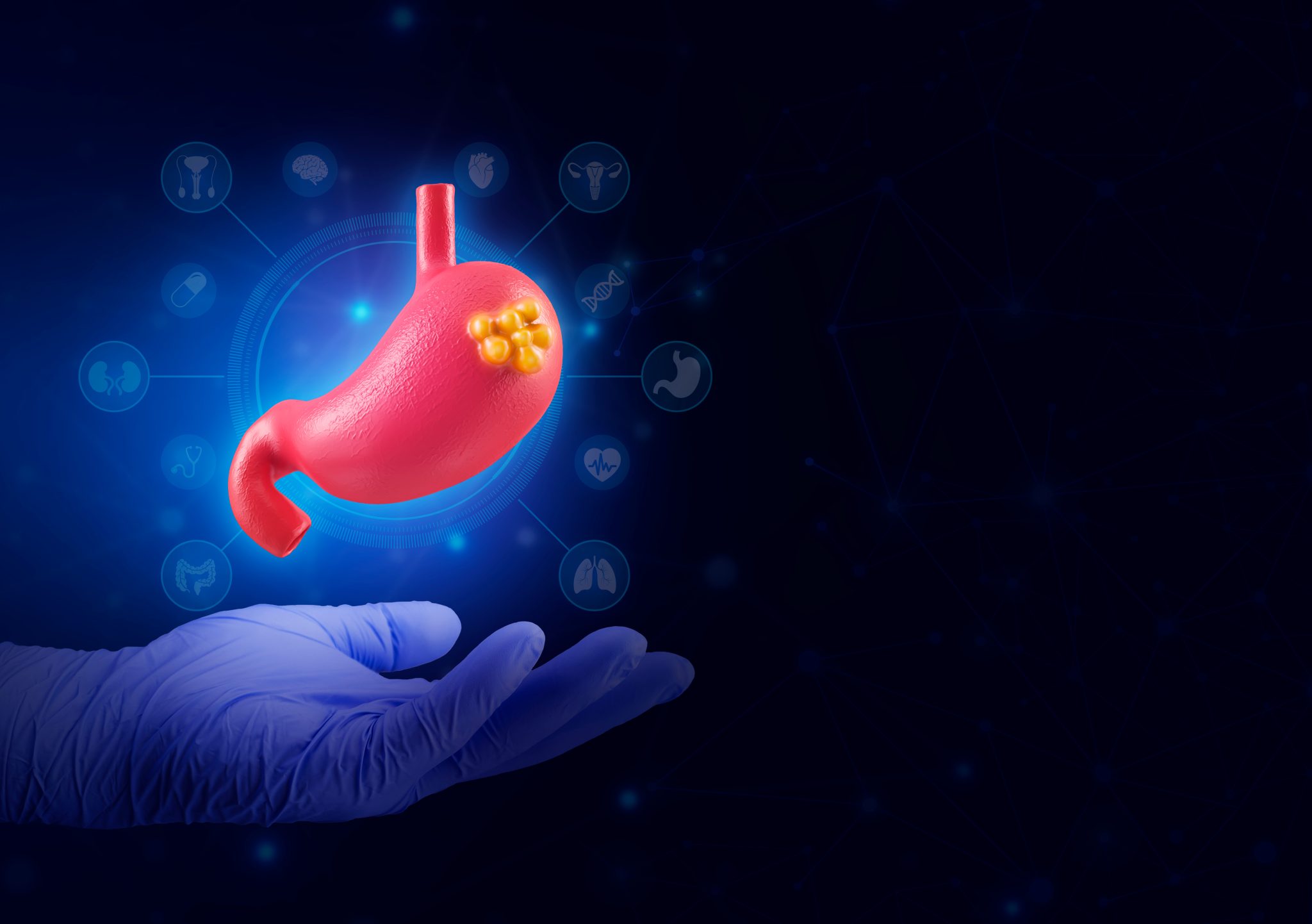 I-Mab Reports Encouraging Data in First-Line Gastric Cancer Treatment - PRISM MarketView