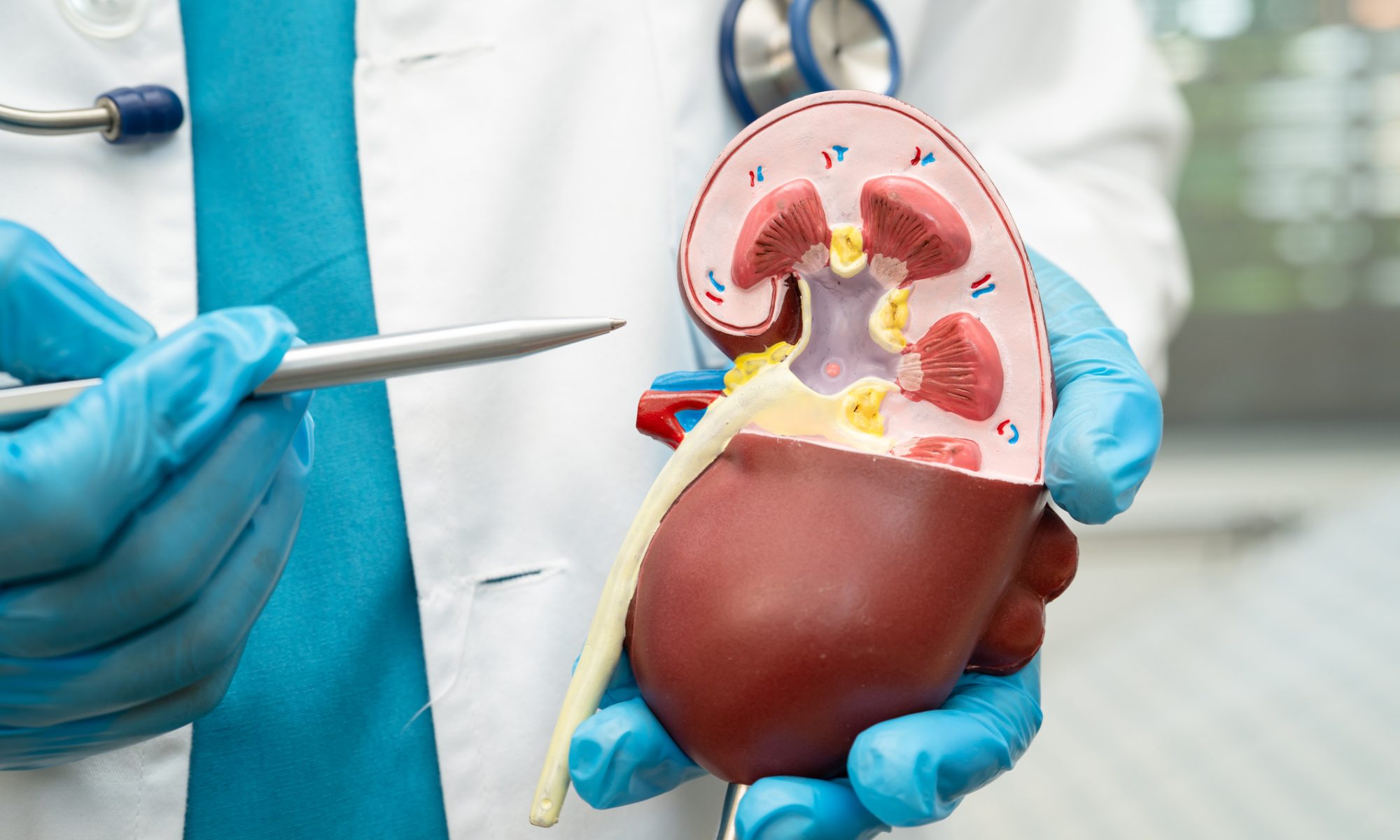 ProKidney Surges After Positive Phase 2 Results for Chronic Kidney ...