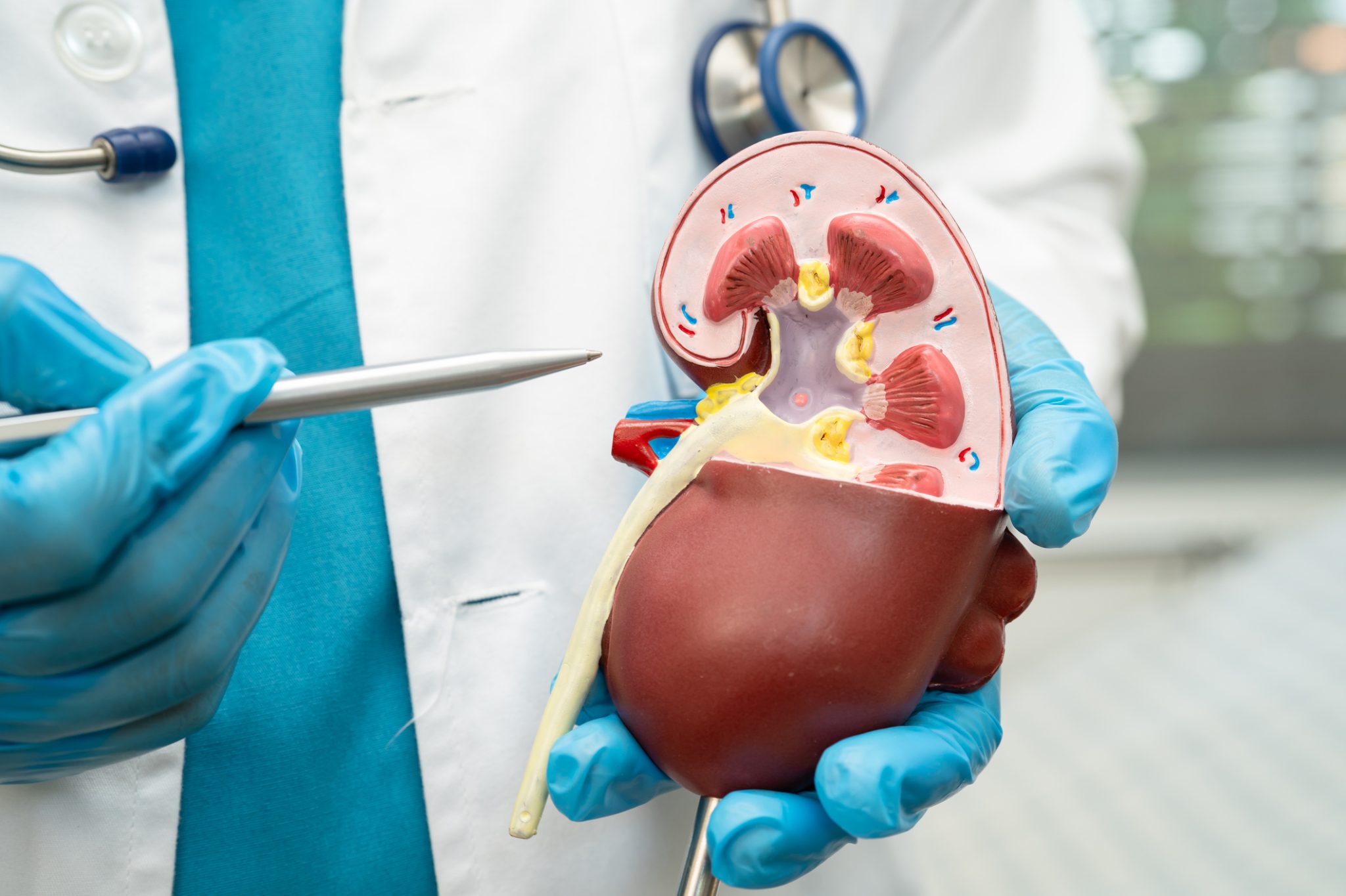 ProKidney Surges After Positive Phase 2 Results for Chronic Kidney ...