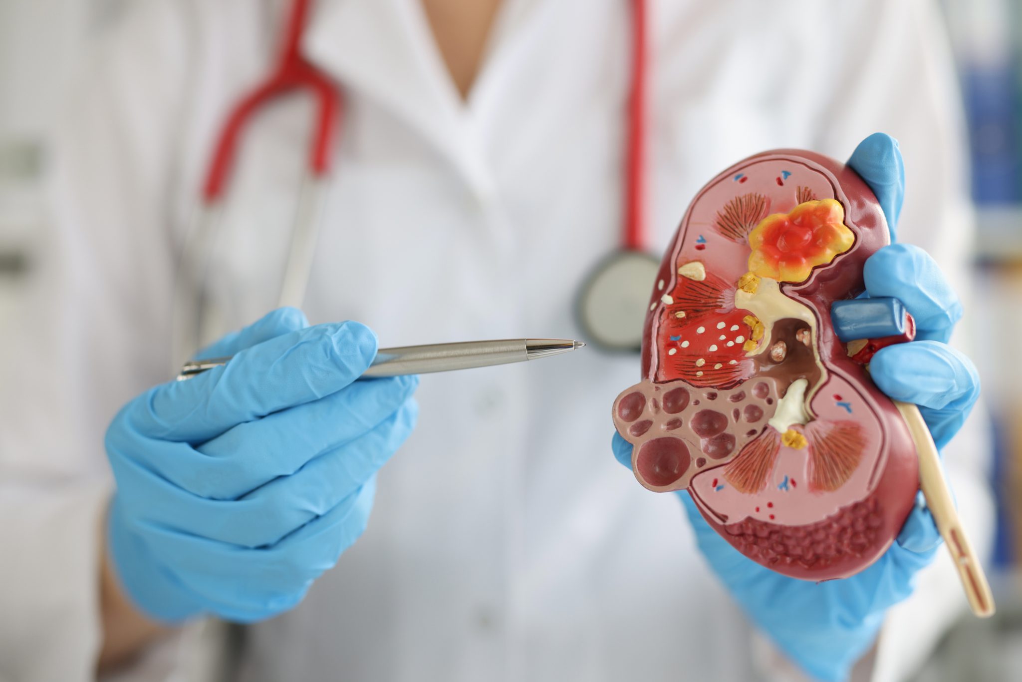 ProKidney Gains Regulatory Momentum as FDA Supports Accelerated ...