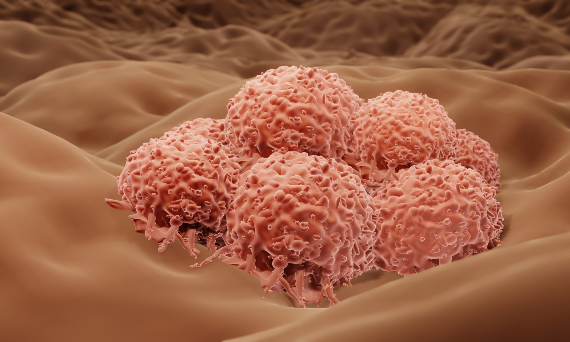 Castle Biosciences Receives Breakthrough Device Designation for ...