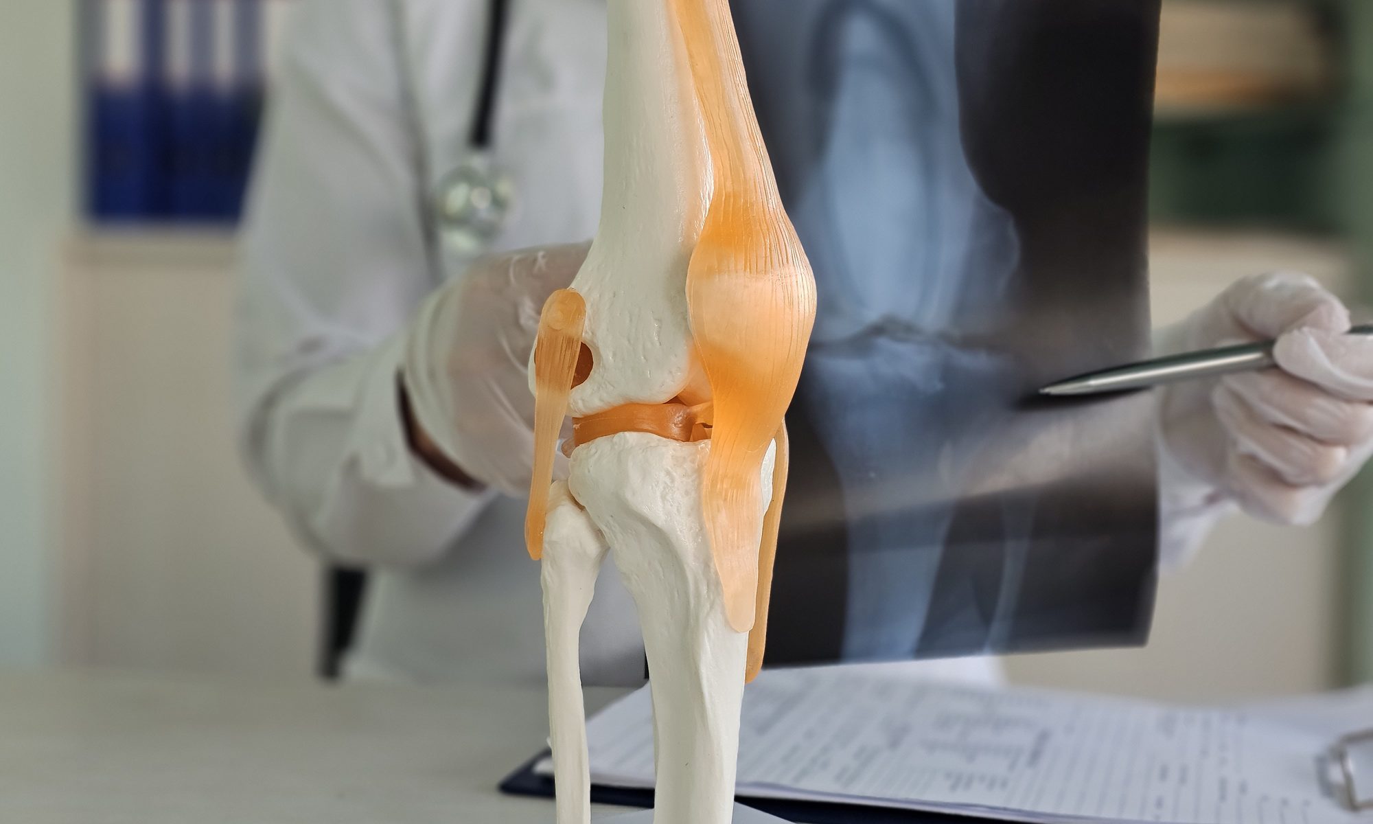 NextCure Soars After Promising Preclinical Results in Brittle Bone ...