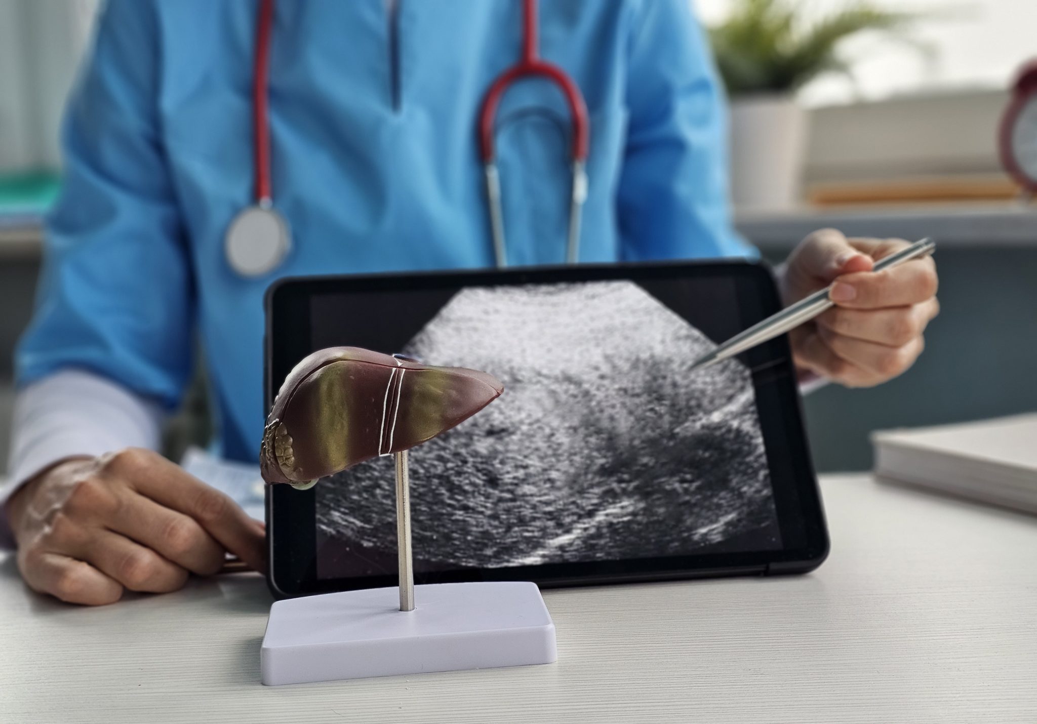 Novo Nordisk’s Wegovy Gains FDA Approval for MASH Treatment - PRISM ...