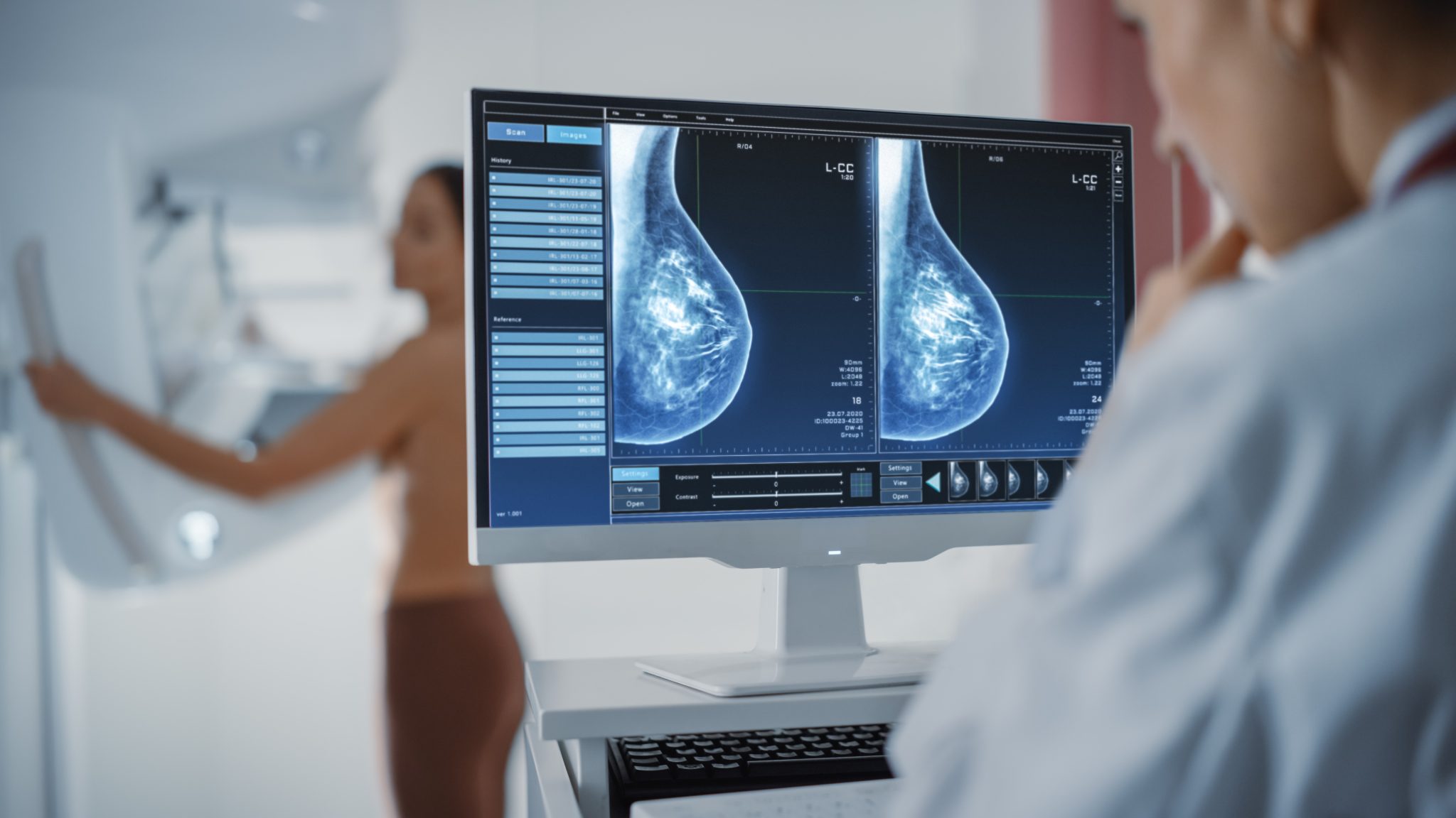 Olema and Pfizer Partner on New Breast Cancer Study - PRISM MarketView