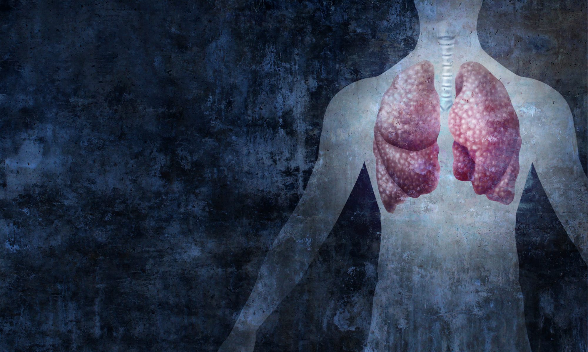 GRI Bio Reports Encouraging 6-Week Interim Data for GRI-0621 in ...