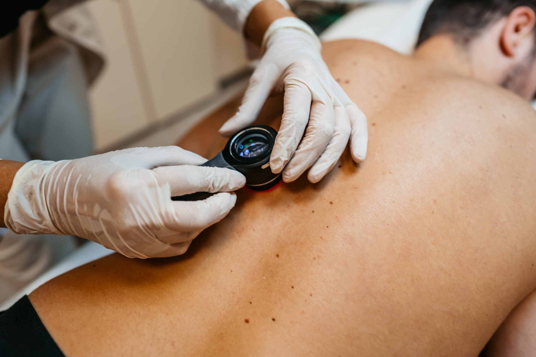 Replimune Shares Surge 98% After New Acral Melanoma Data at ESMO ...
