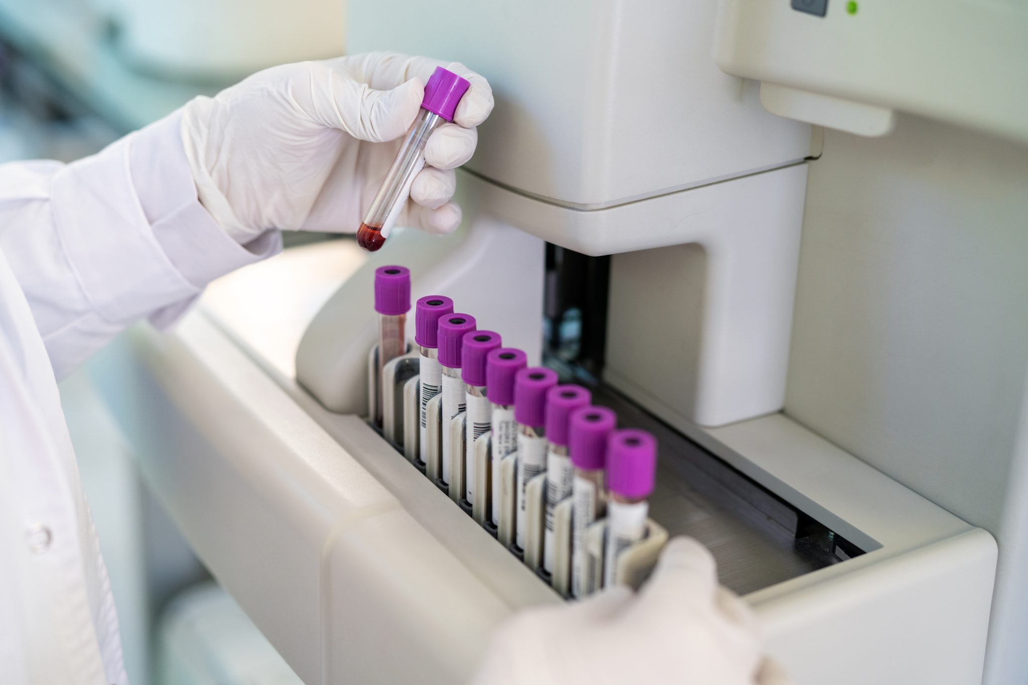 UCB Wins FDA Approval for First-Ever Treatment of Ultra-Rare ...