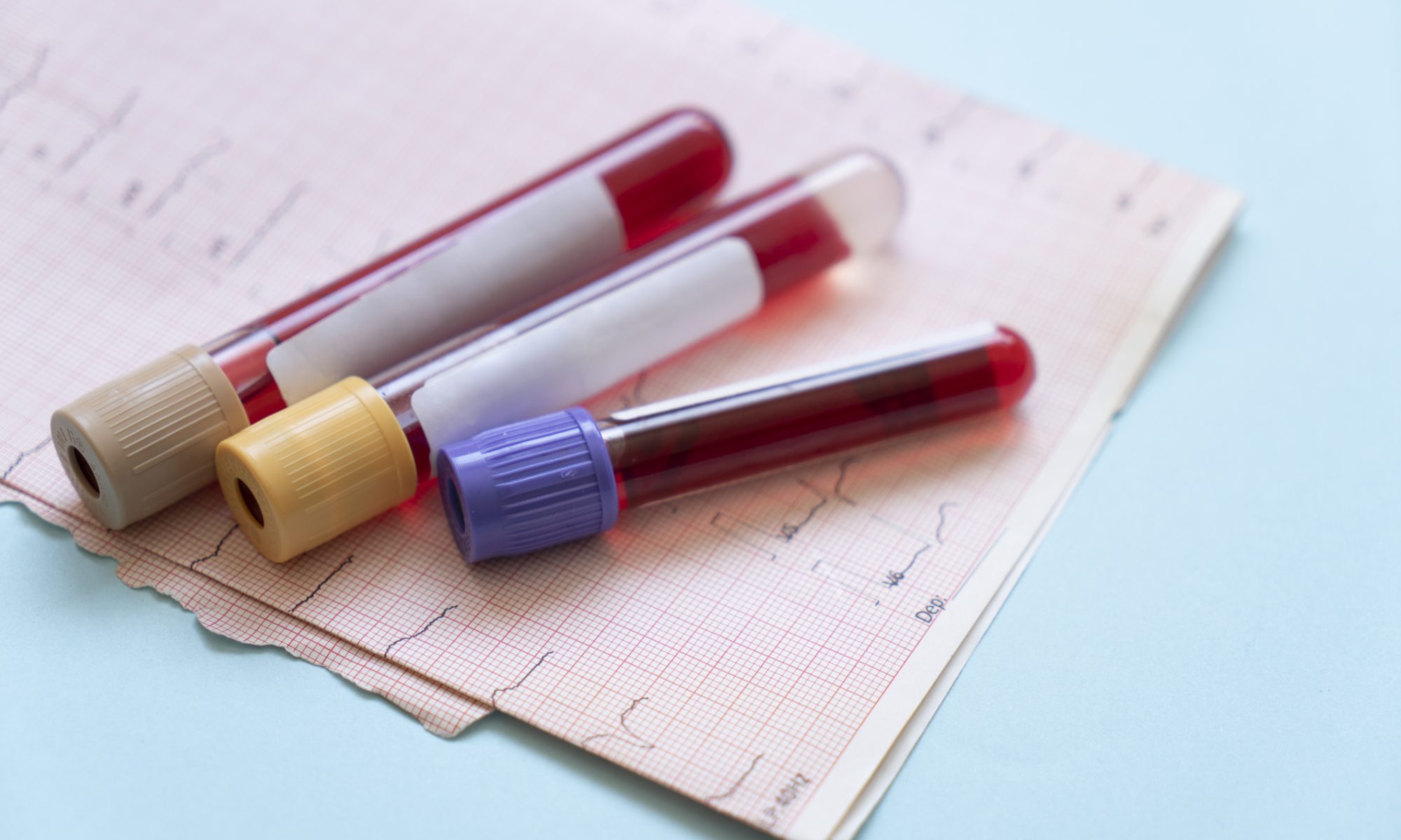 Guardant Health Strengthens Liquid Biopsy Leadership with New ...