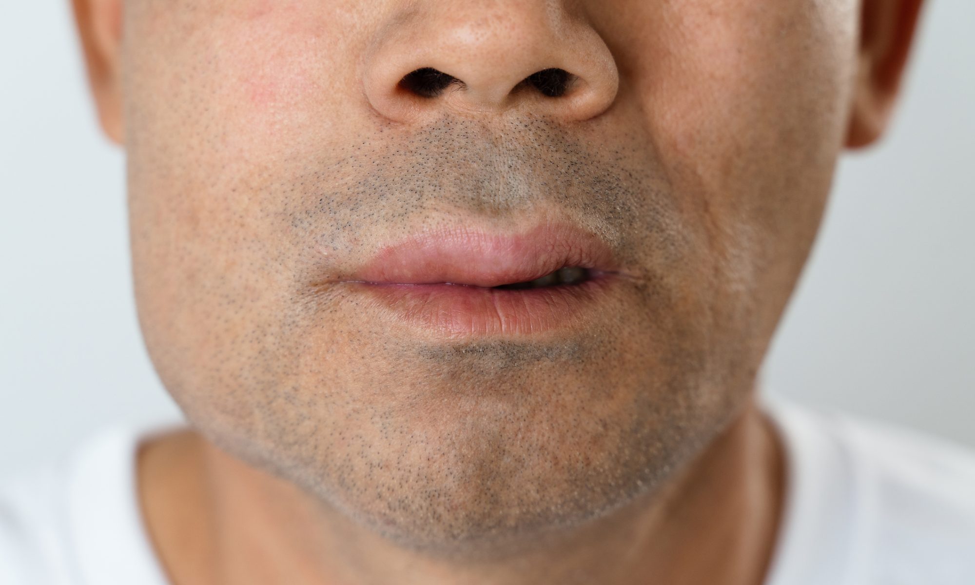 Pharvaris Reports Strong Phase 3 Results Supporting Deucrictibant for ...