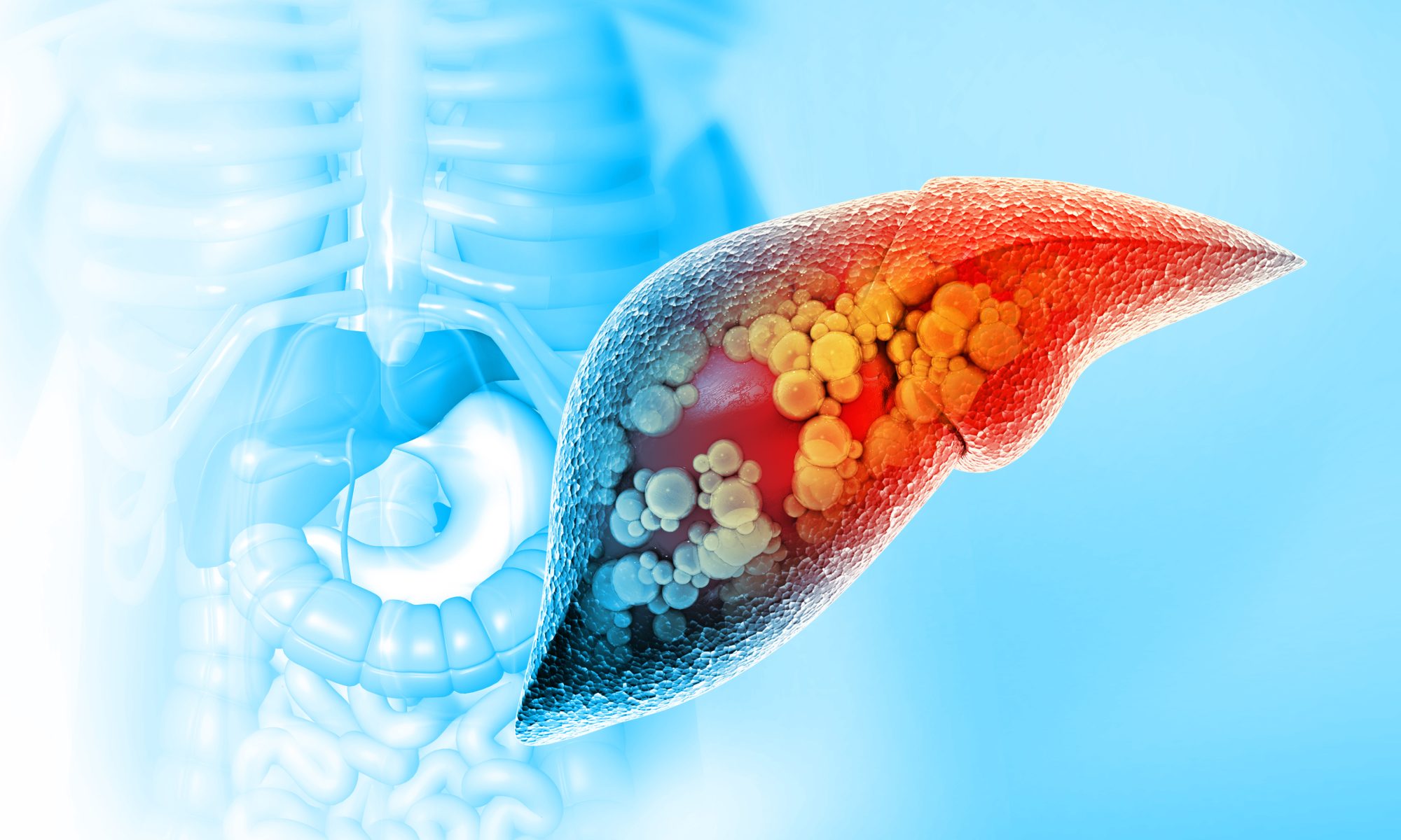 BeOne Medicines’ Liver Cancer Therapy Receives FDA Fast Track ...