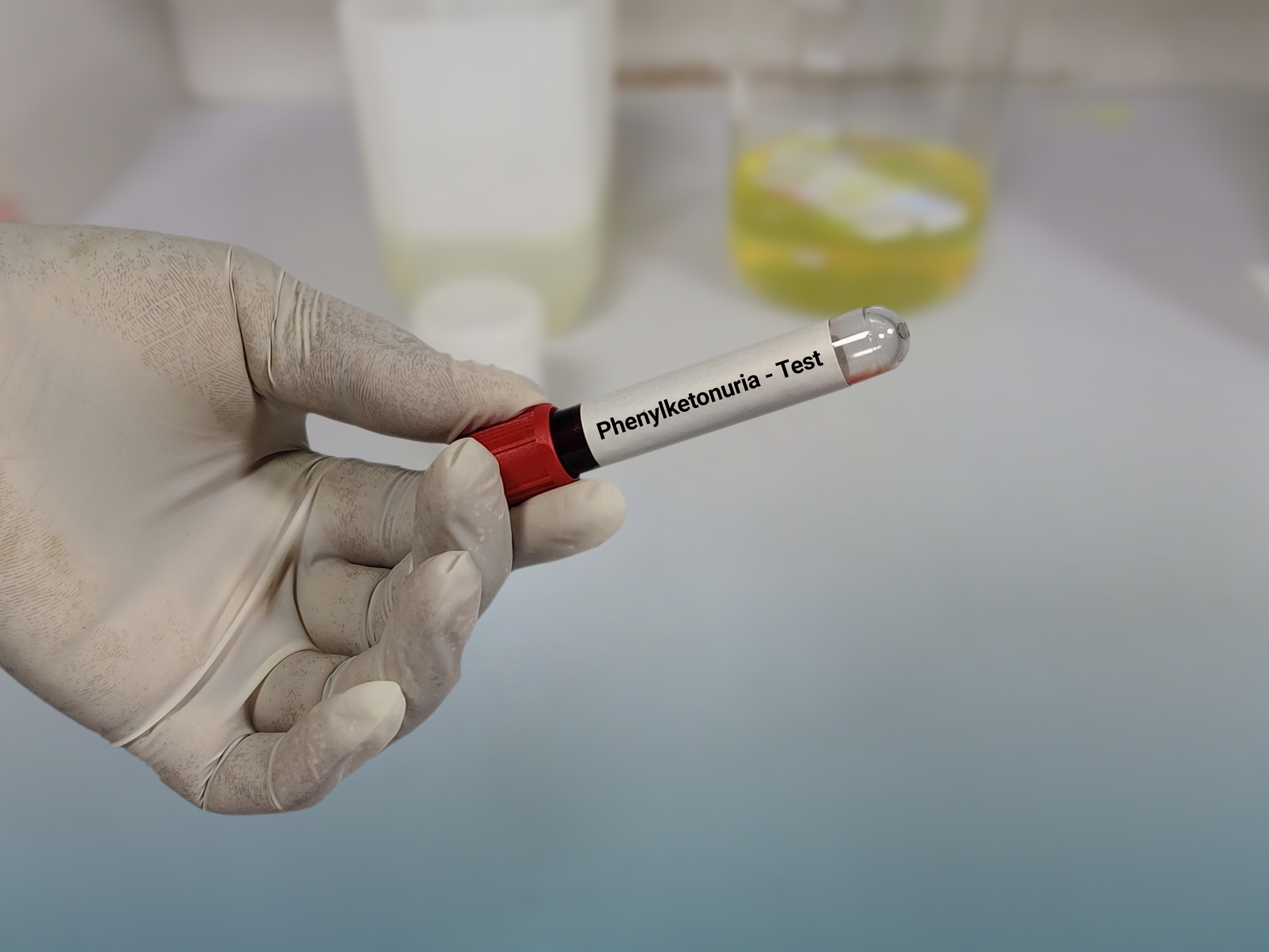 Aurora Therapeutics Moves to Harness FDA’s New Bespoke Drug Framework ...