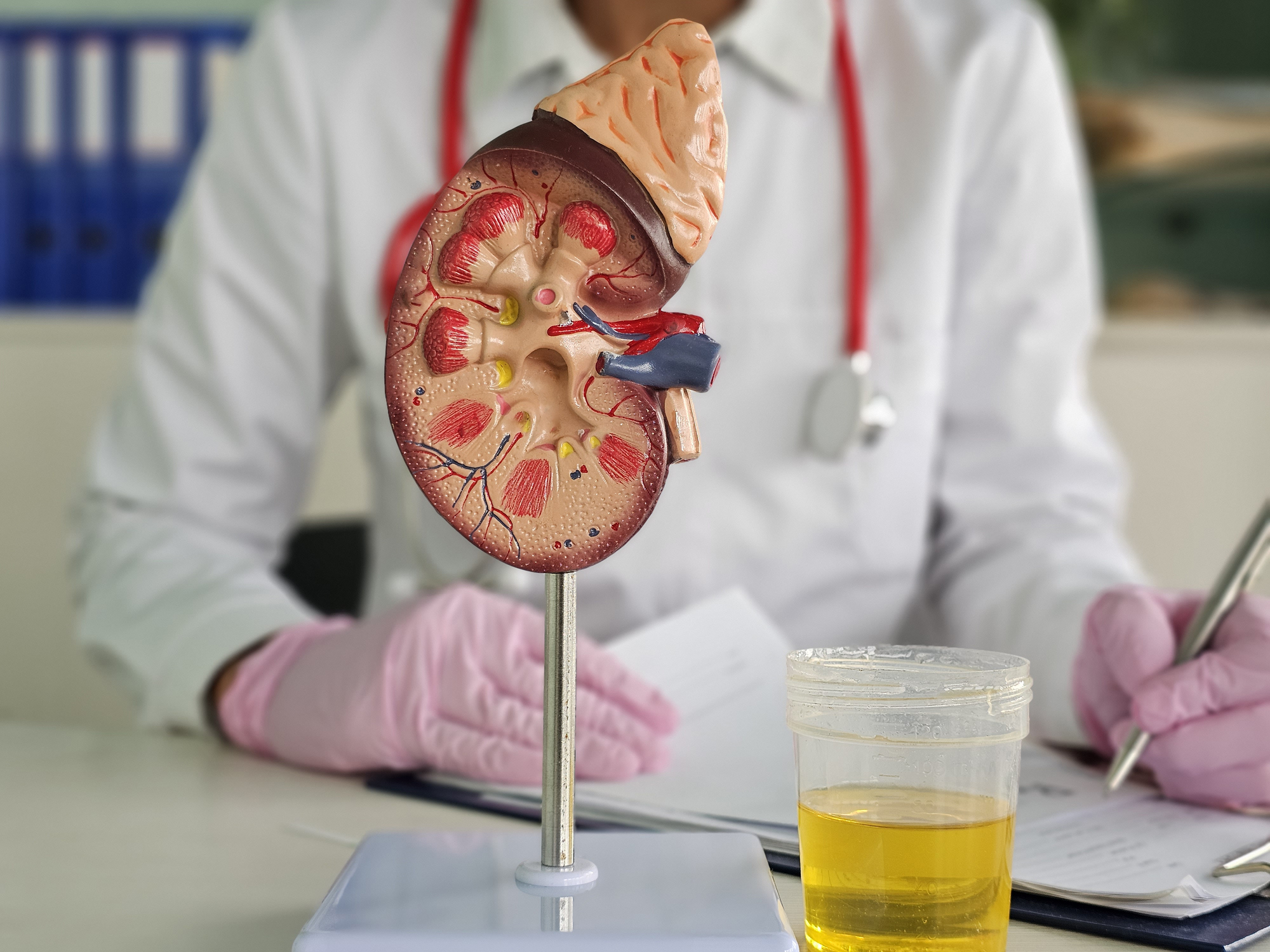 Jade Biosciences, Inc. Begins Phase 2 JUNIPER Trial for IgA Nephropathy ...